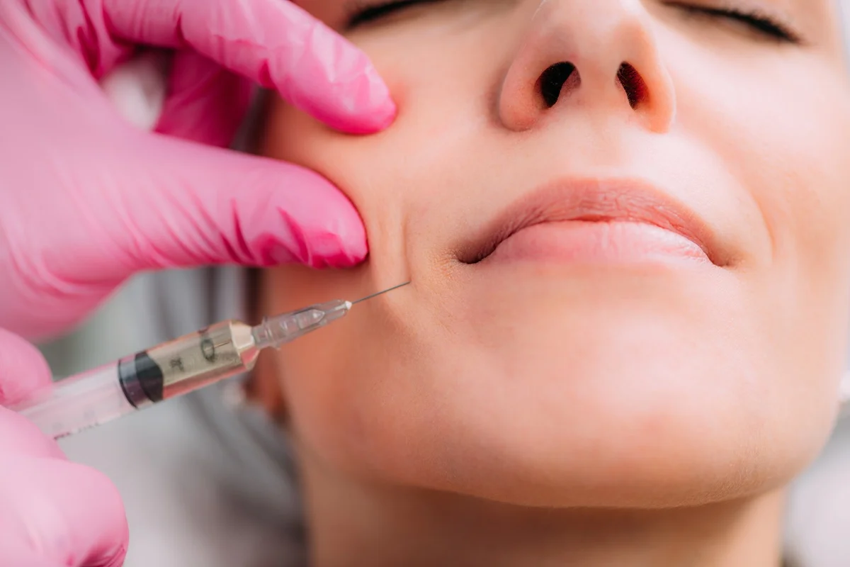 Best Dermal Fillers in New York, NY | Sculptra & Radiess
